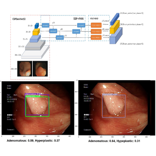 Colorectal polyp detection based on deep learning approaches-MING CHI ...